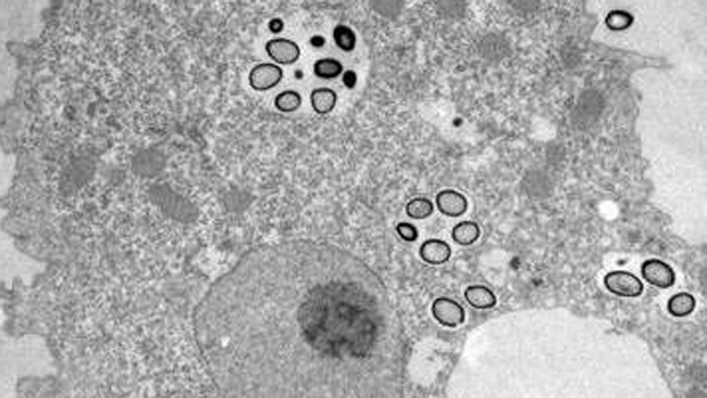 Este es el virus más grande del mundo