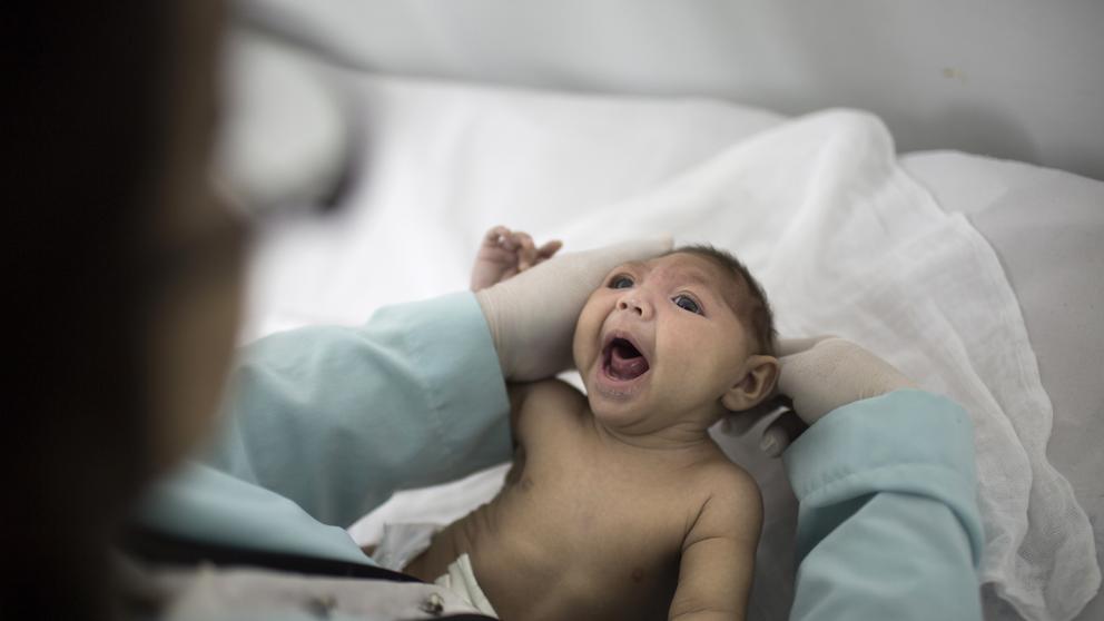 Aumentan a 21 los nacimientos de niños con microcefalia en Honduras